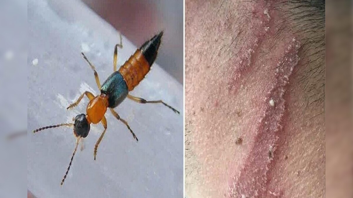 What is Nairobi Fly: নাকামোৰে, হুলেৰেও নিবিন্ধে, তাৰ পিছতো নাইৰোবিৰ ...