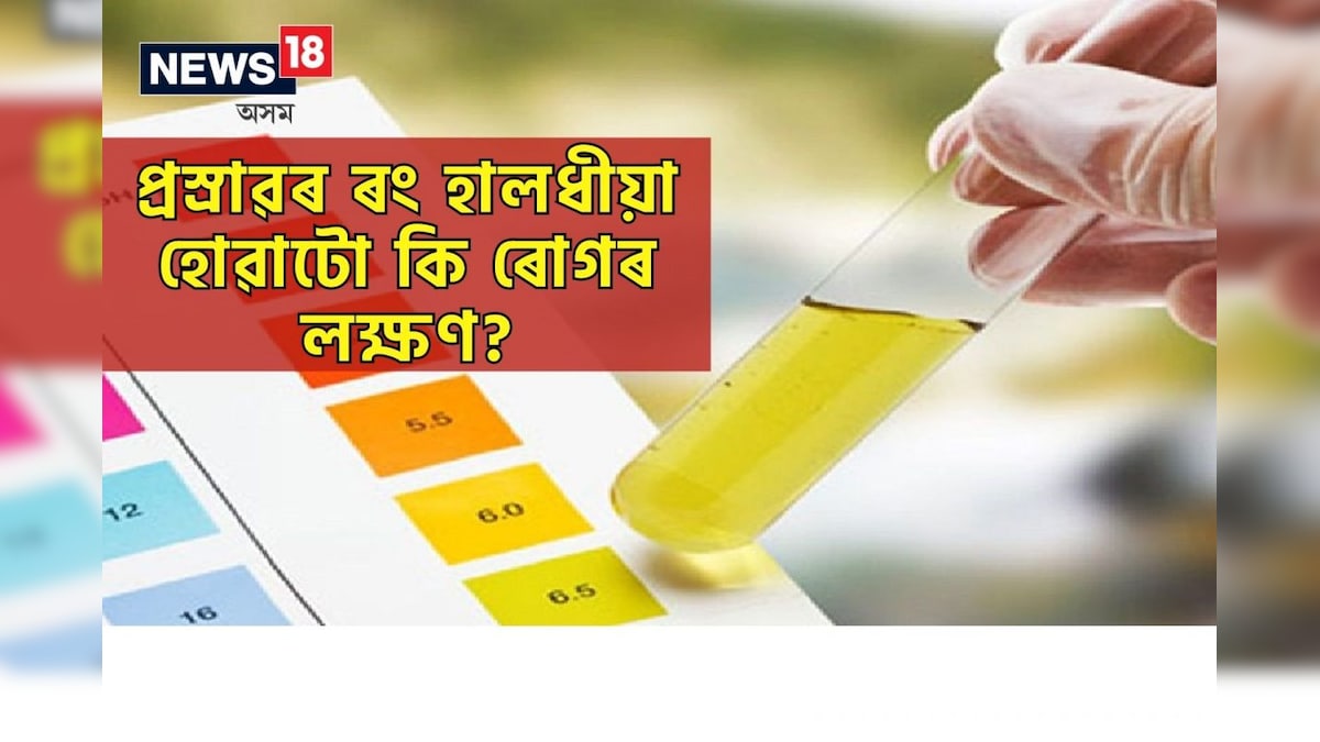 Yellow Urine Causes: গৰমত আপোনাৰো হালধীয়া ৰঙৰ প্ৰস্ৰাৱ হৈছে নেকি? ই কি ...