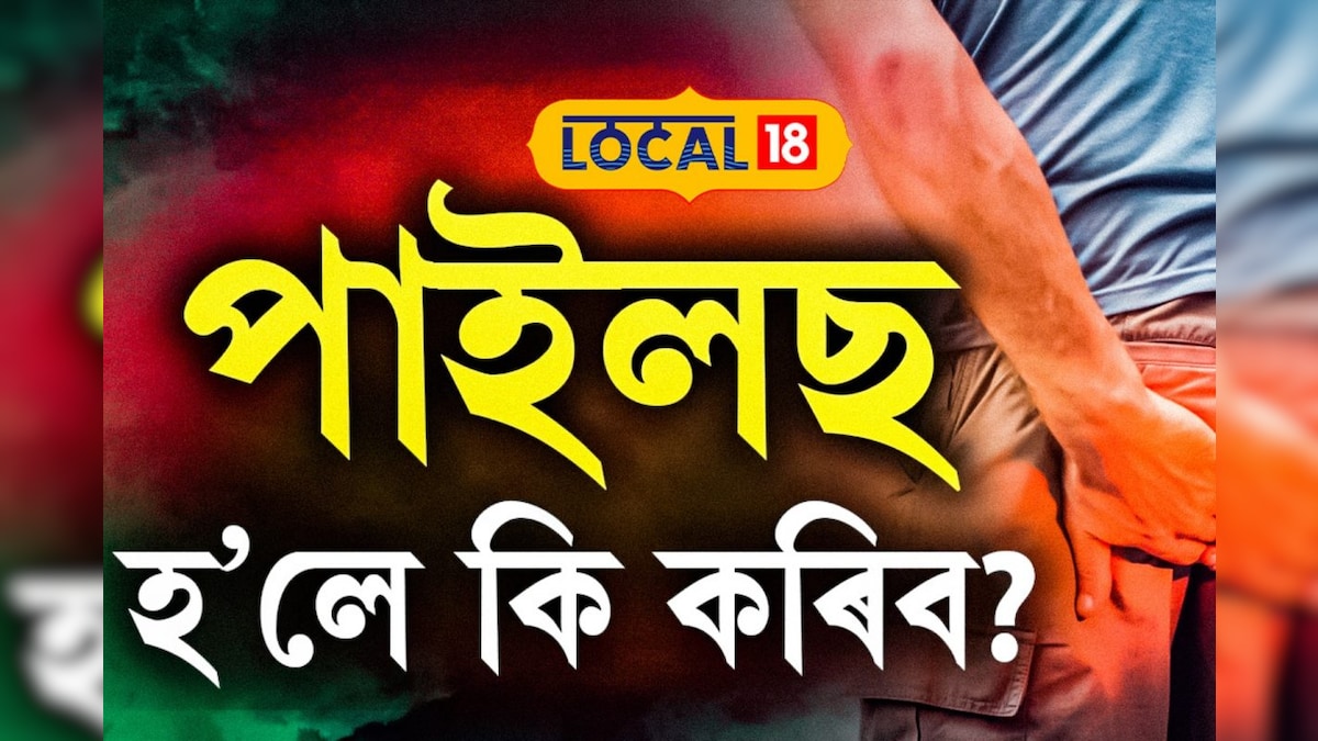 Causes of piles problems and precautions to take. Let's learn from ...