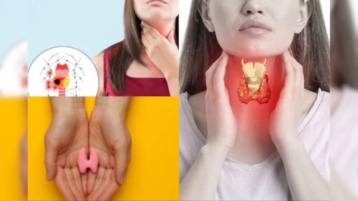Thyroid Control Tips : থাইৰয়ড কমা নাই? নিয়মিত খাওক এই তিনিবিধ খাদ্য! দূৰ হ’ব থাইৰয়ডৰ সমস্যা ...