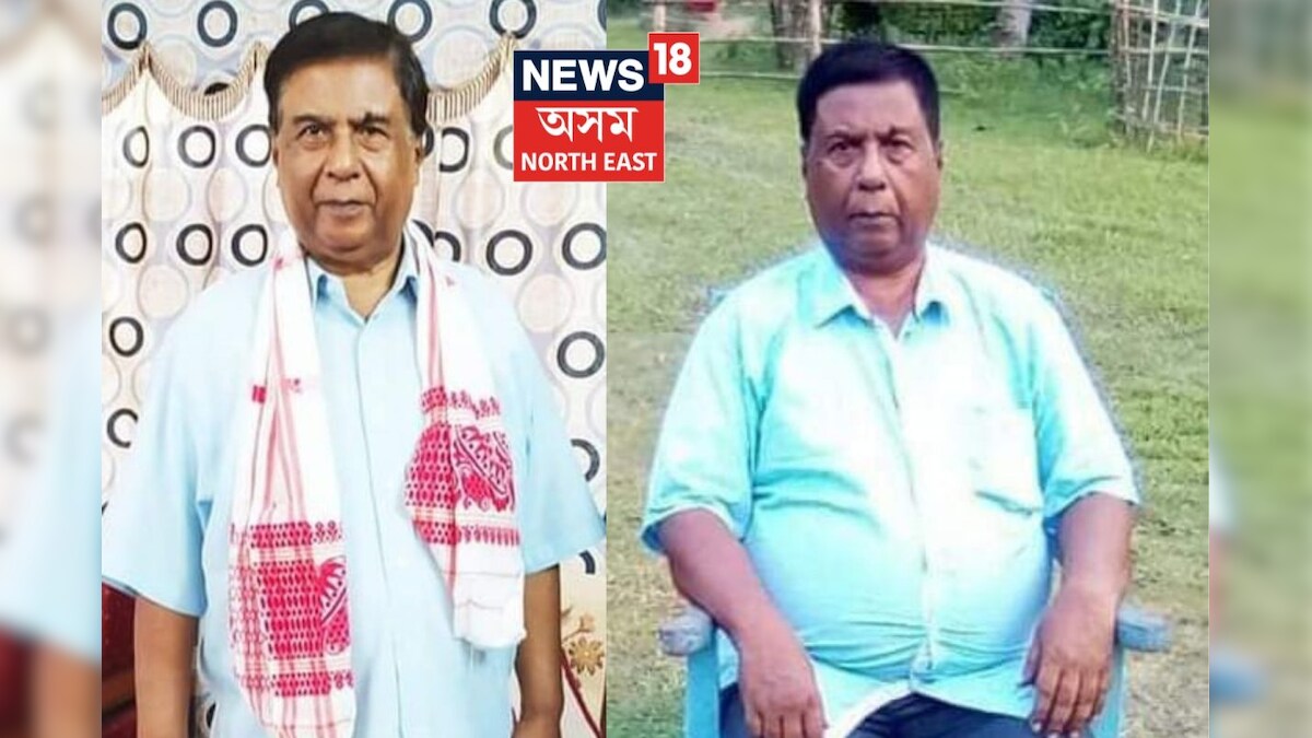 Shashi Phukan: চিকিৎসালয়ত ICUৰ বিচনাত 'বিস্ময়'ৰ সম্পাদক শশী ফুকন ...