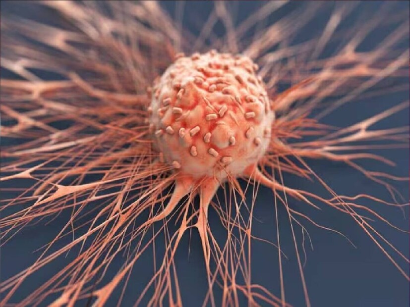 Bone Cancer Symptoms: এয়াই হাড়ৰ কেঞ্চাৰৰ প্ৰথম লক্ষণ! শৰীৰত এই ৫টা ...