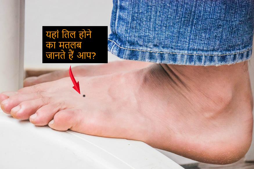 Mole On Left Foot Female Clearance | emergencydentistry.com