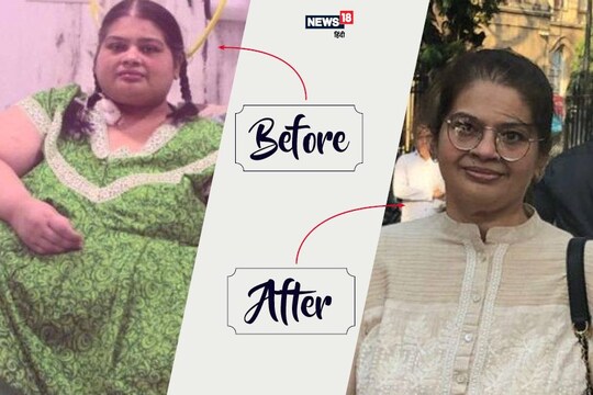 300 kg women loss 214 kg weight in 4 years bgys|दुनिया के सबसे मोटी ...