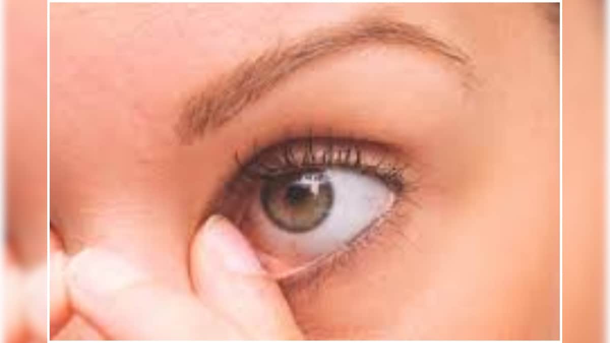 know what is lazy eye and never ignore these symptoms myupchar pur ...