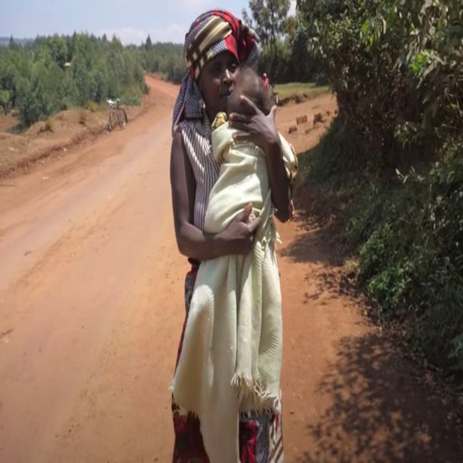 'एलियन' जैसी शक्ल बता पिता ने तोड़ा था रिश्ता, अब बच्चे के इलाज को ...