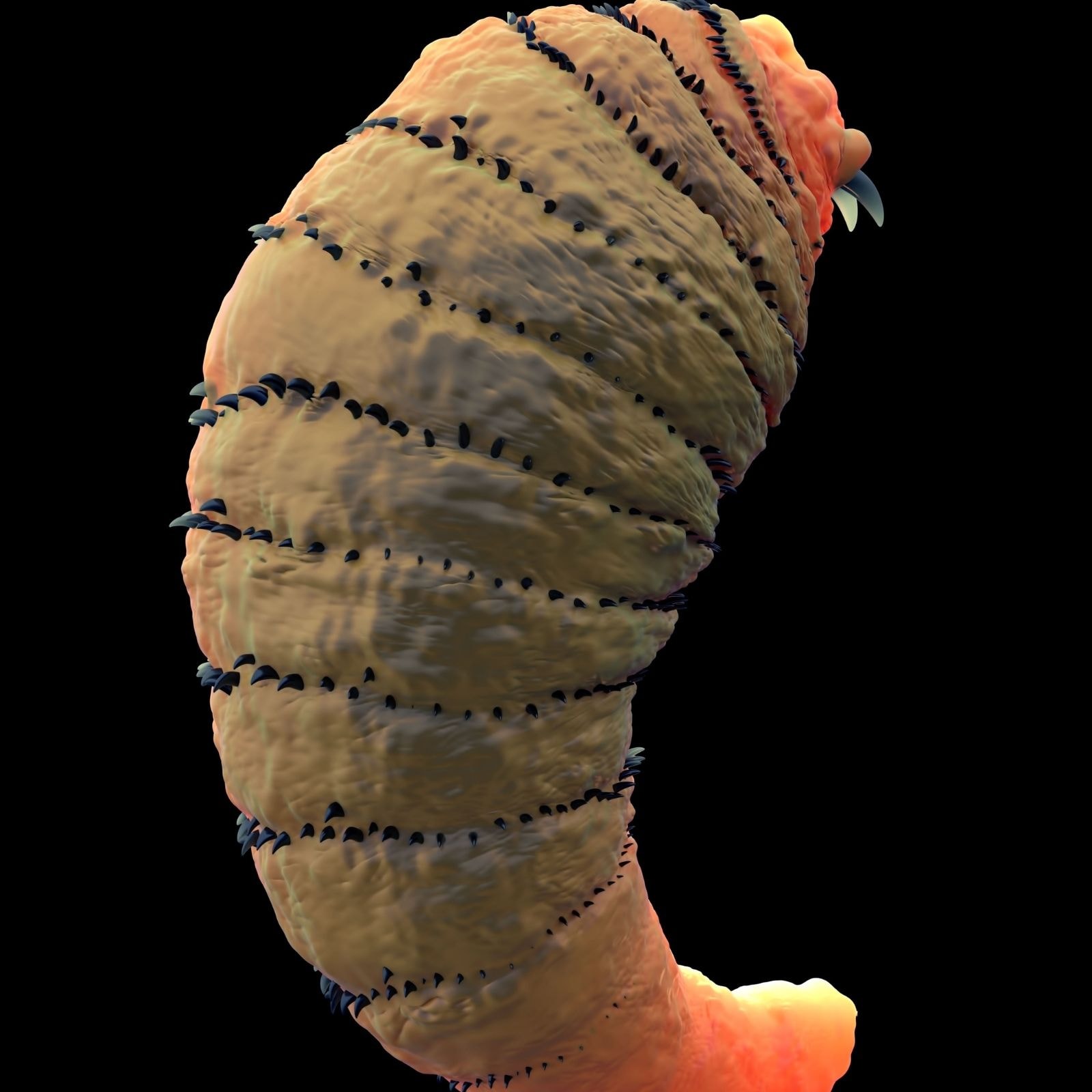 महिला के शरीर में ऐसी जगह घुसकर घूमने लगे ज़िंदा कीड़े, सर्जरी कर ...