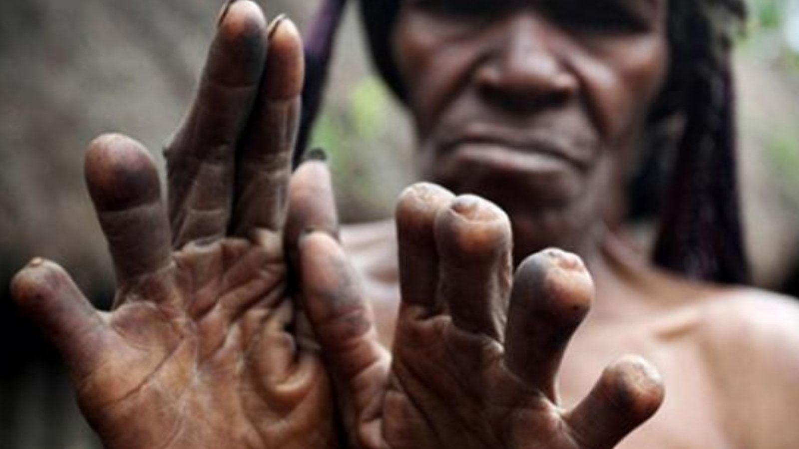 प्रियजनों के मरने पर महिलाएं काट लेती हैं अपनी उंगलियां! अनोखी जनजाति ...