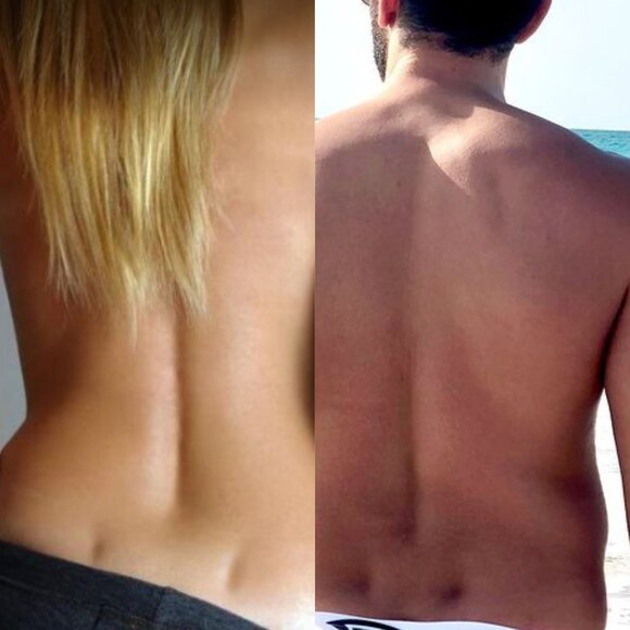 पीठ के निचले हिस्से पर क्यों होते हैं 2 डिंपल? माना जाता है बेहद लकी ...