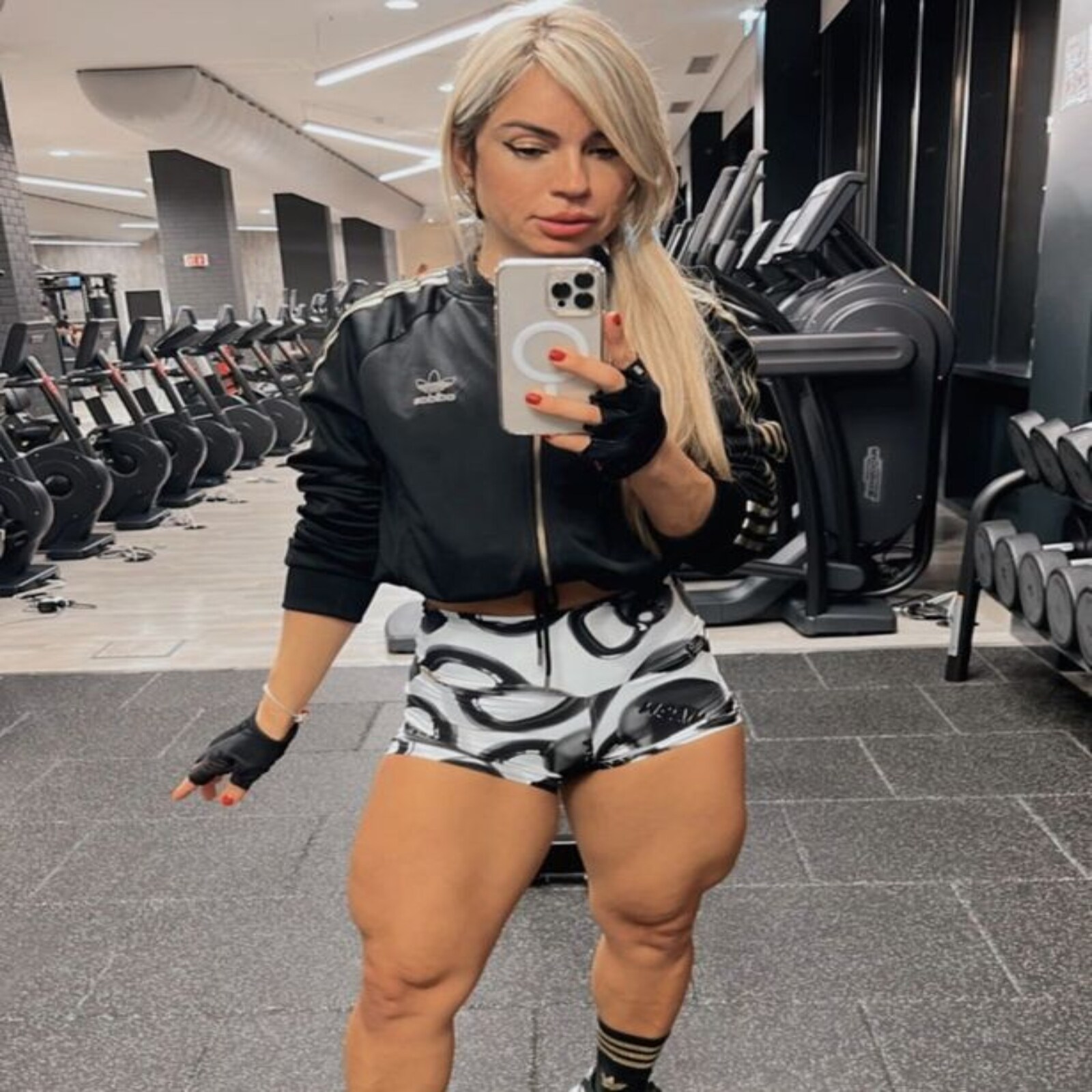 एक्सरसाइज करते-करते पेड़ के तने-सा हो गया महिला का पैर, कोई लड़का नहीं ...