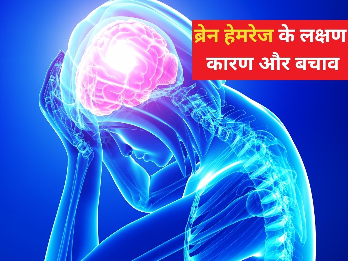 जानलेवा हो सकता है ब्रेन हेमरेज, जानें लक्षण, कारण और बचाव के उपाय ...