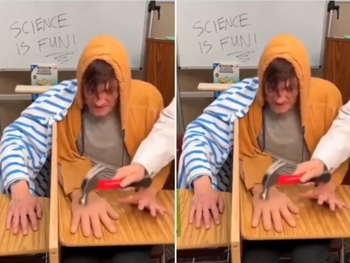 नकली हाथ को छूने से भी मेहसूस होने लगा स्पर्श, जादू है या विज्ञान का ...