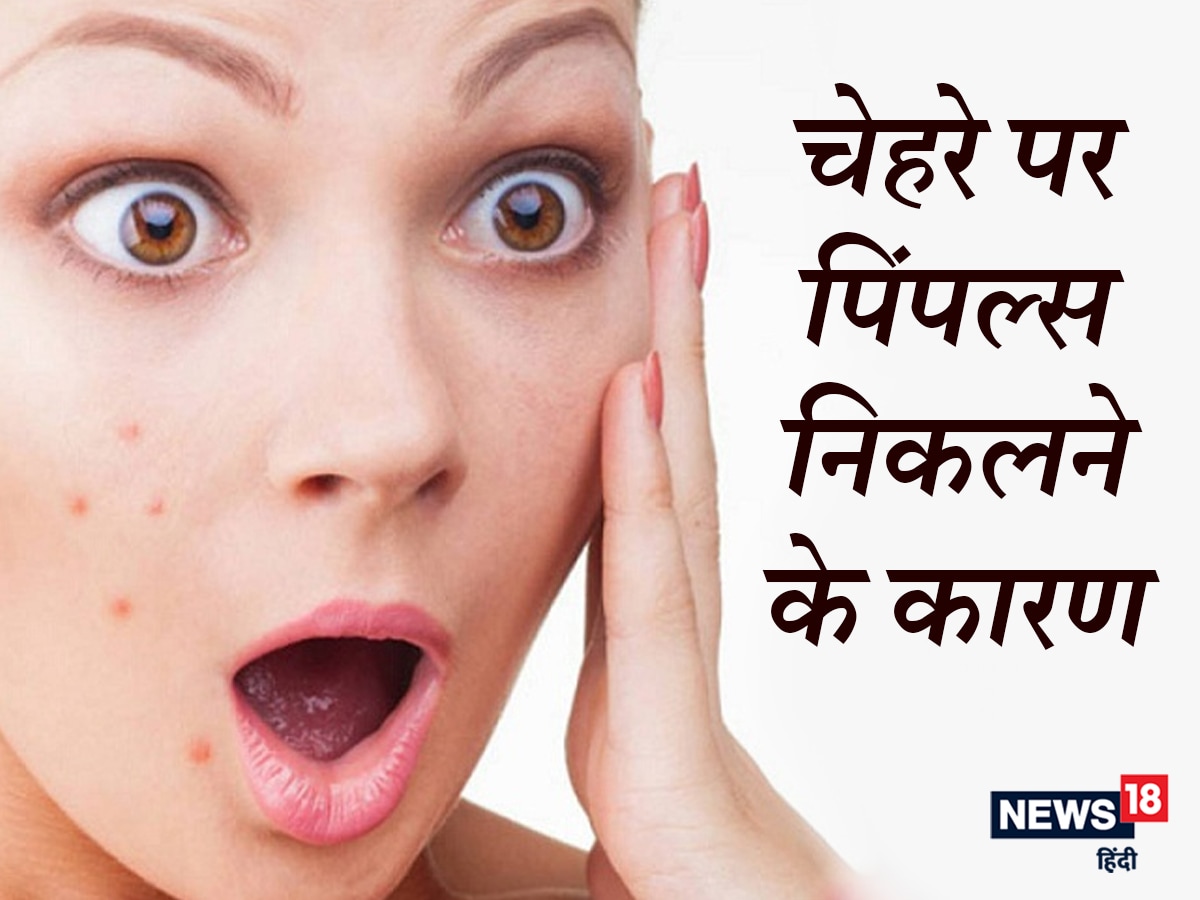इस विटामिन की कमी से युवाओं के चेहरे पर निकलते हैं पिंपल्स, आज ही ...