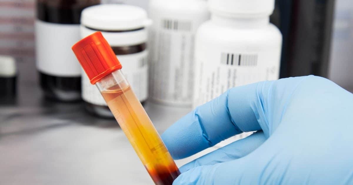 Thick Blood: क्या हैं ब्लड गाढ़ा होने के कारण और लक्षण, जानें इसके ...