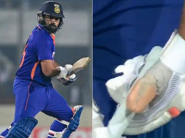 रोहित शर्मा के हाथ में लगी Split Webbing चोट क्या है? कैसे और कितने ...
