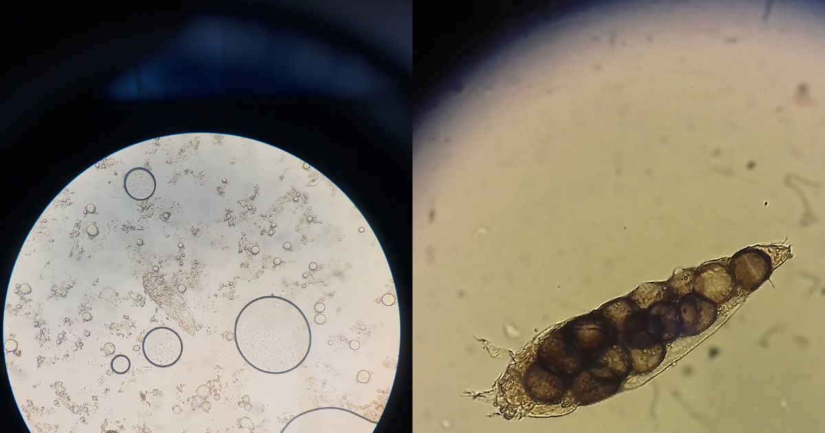 हर वक्त आपके चेहरे पर घर बनाकर रहते हैं सैकड़ों कीड़े, रात में बढ़ाते ...