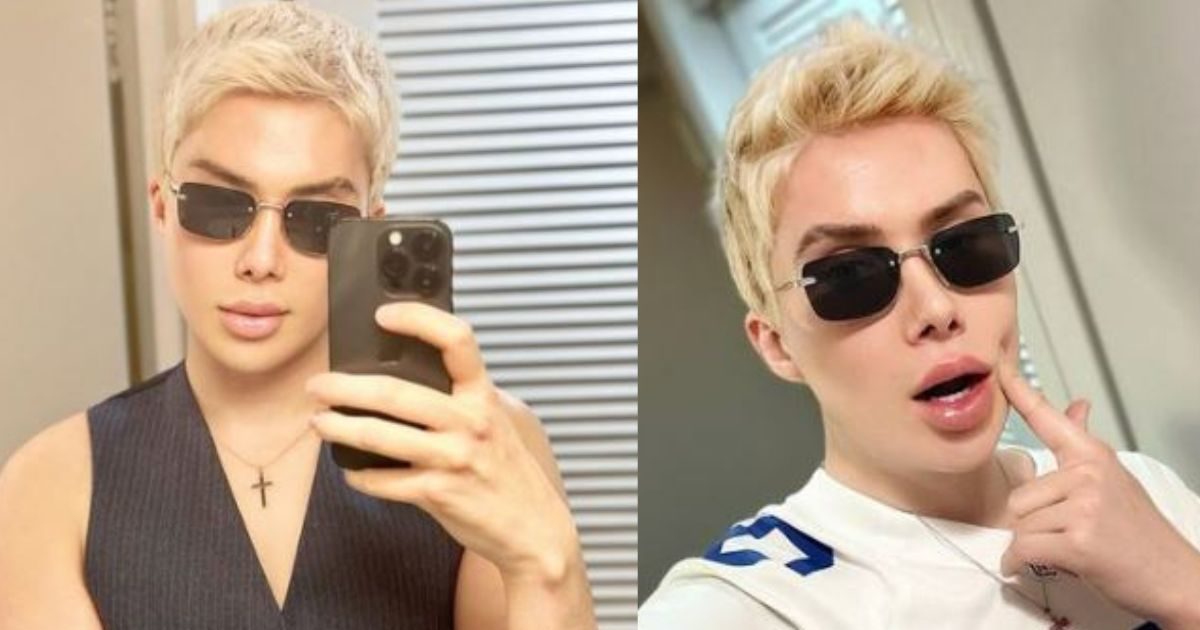 First transracial people of world spent millions for look like korean ...