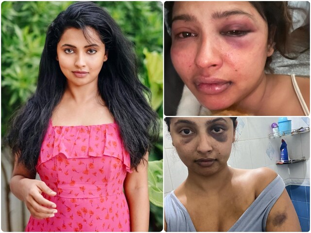 Malayalam actor anicka vikhraman accuses ex boyfriend anoop pillai of ...