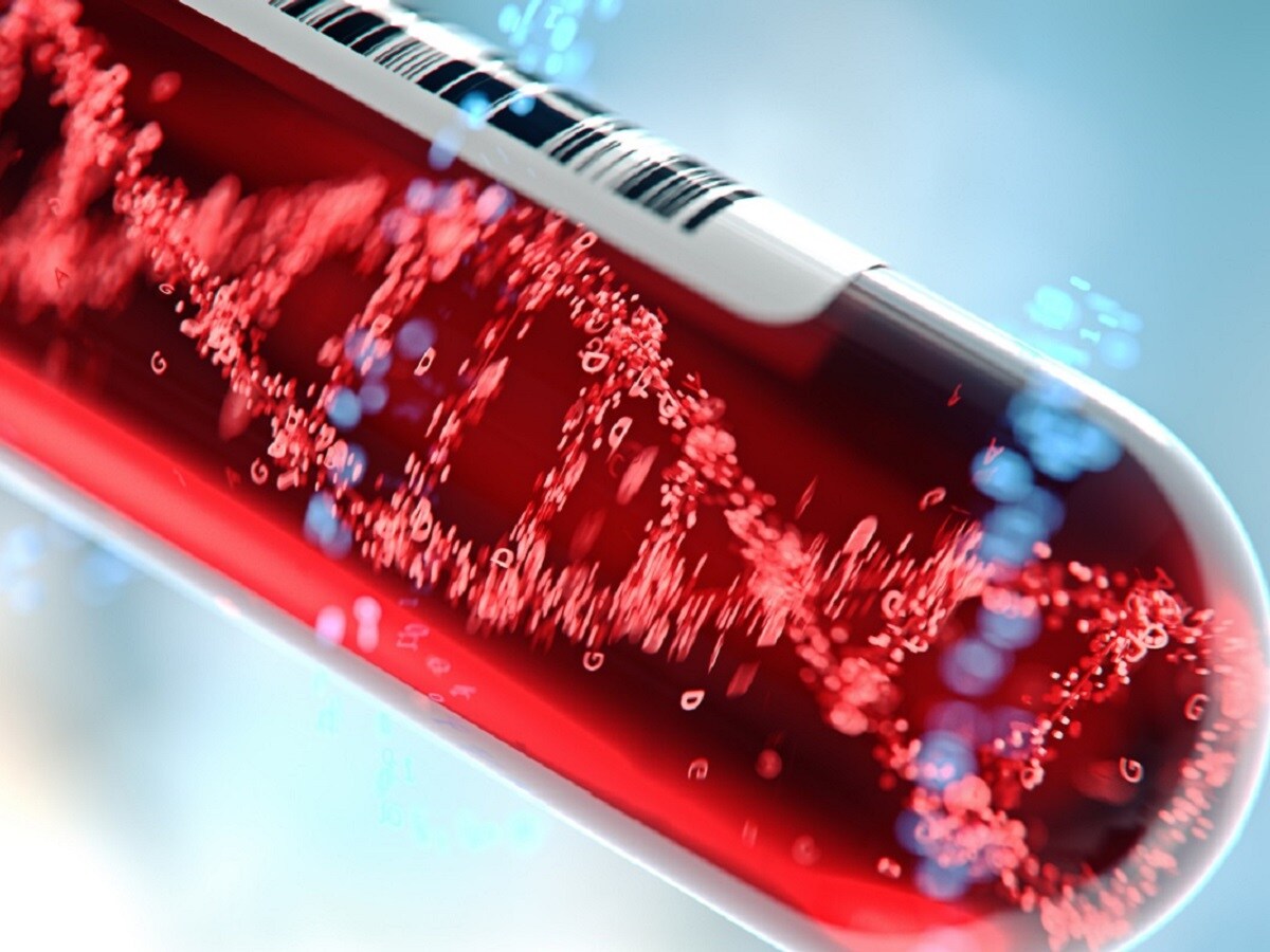 Blood Test for Anxiety developed by scientists - अब घबराहट का भी होगा ...