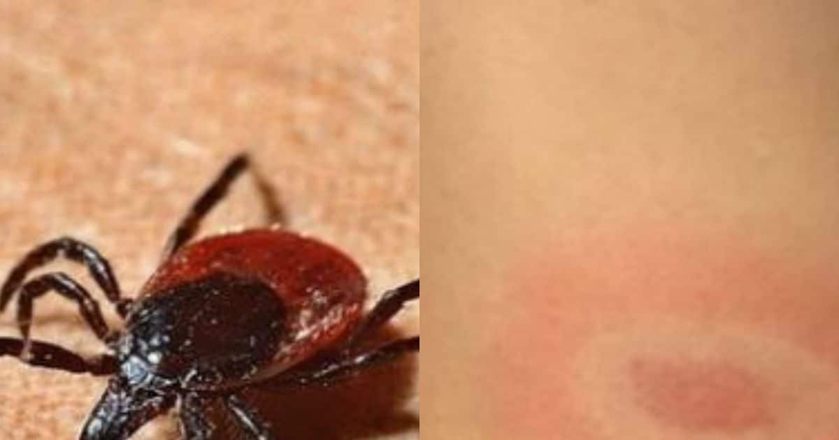 मां से बच्‍चे तक पहुंची यह दुर्लभ बीमारी, धीरे-धीरे मौत की ओर ले जा रही ...
