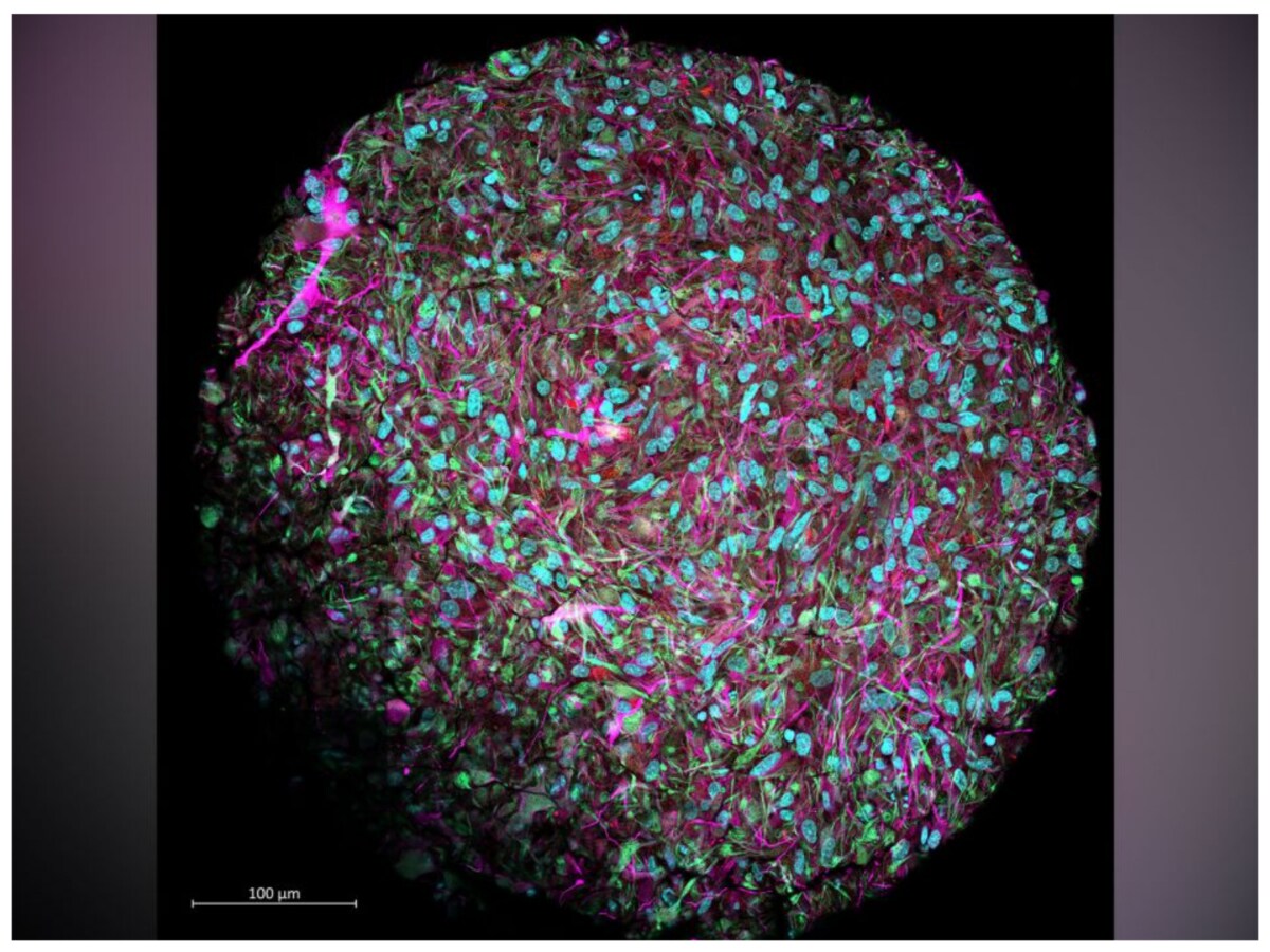What is biocomputer brain computer organoid better then artificial ...