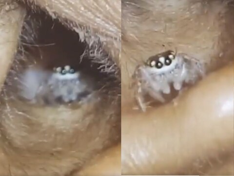 Spider inside ear of woman in shocking video spider crawls out of womans ear watch the video ...