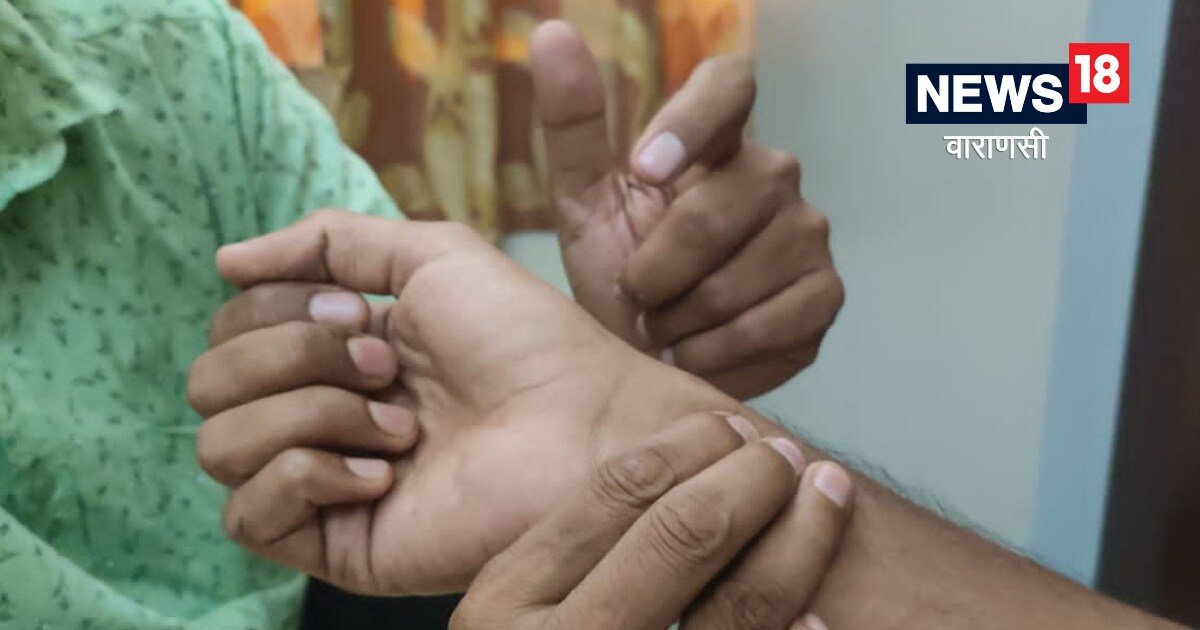 Health News: नो अल्ट्रासाउंड नो ब्लड टेस्ट, BHU में इस पुरानी टेक्निक ...