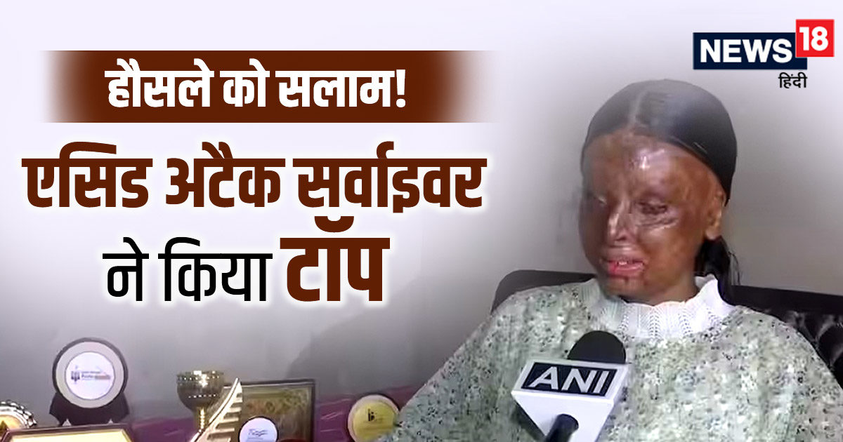 Success Story: 3 साल की उम्र में हुआ एसिड अटैक, ब्लाइंड स्कूल से दी ...