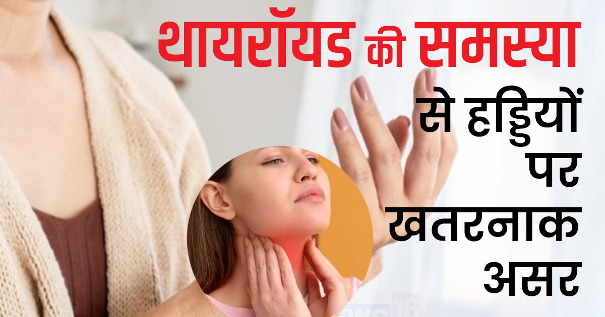 थायरॉयड का खतरनाक लेवल में बढ़ना हड्डियों को भी लगता है गलाने, इन 7 ...