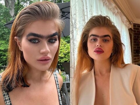 भौं नहीं माथे पर उगा है जंगल! महिला की Eyebrow देखकर लोग उड़ाते हैं ...