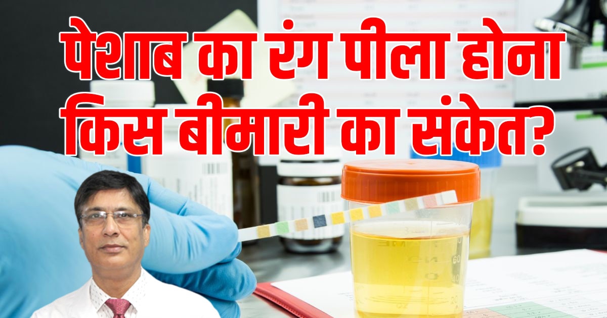Yellow Urine Causes: गर्मियों में आपको भी आ रहा पीले रंग का पेशाब, किस ...