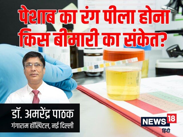 Yellow Urine Causes: गर्मियों में आपको भी आ रहा पीले रंग का पेशाब, किस ...