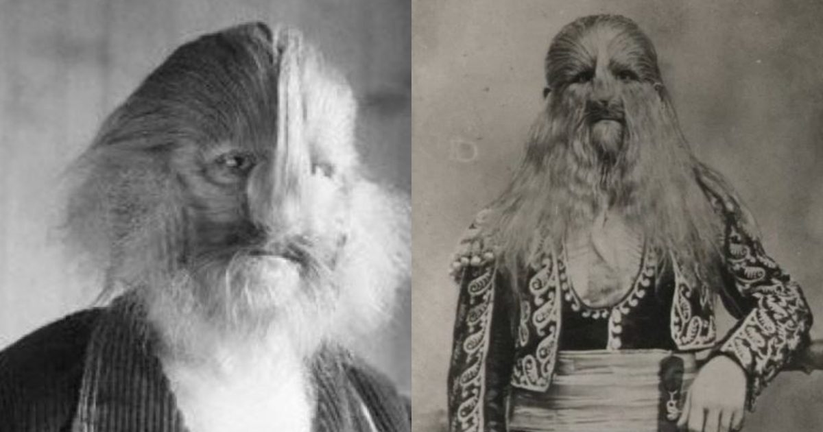 दिग्गज एंटरटेनर था ‘शेर के चेहरे’ वाला यह शख्स, जिसने ‘दहाड़ते’ हुए ...