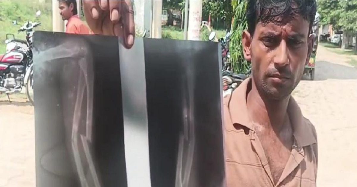 UP News: फतेहपुर में क्रूर प्रिंसिपल की पिटाई से मासूम का हाथटूटा ...