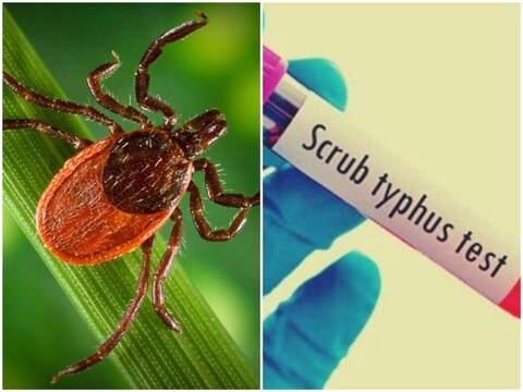 स्‍क्रब टाइफस क्‍या है? रहस्‍यमयी बुखार के बढ़ रहे केस, क्‍या हैं लक्षण ...
