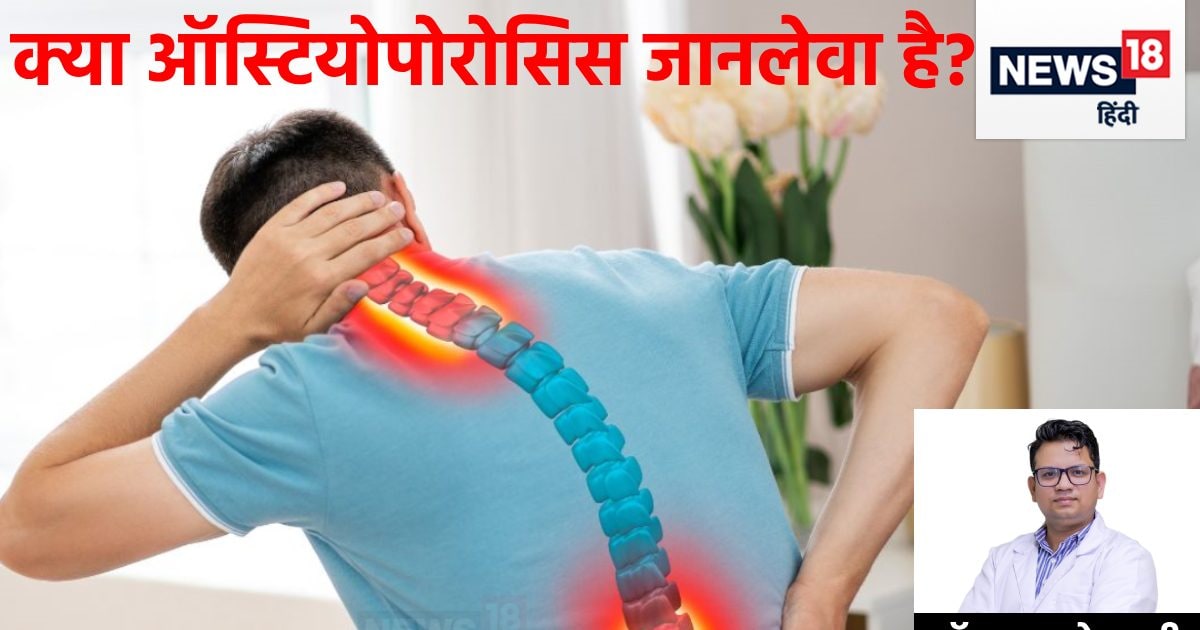 World Osteoporosis Day: क्या हड्डियों की बीमारी ऑस्टियोपोरोसिस से मौत ... World Osteoporosis Day: क्या हड्डियों की बीमारी ऑस्टियोपोरोसिस से मौत ...