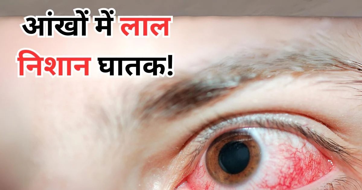 सावधान! नए रूप में तबाही मचा रहा Covid-19, इस देश में दिखे इसके लक्षण ...