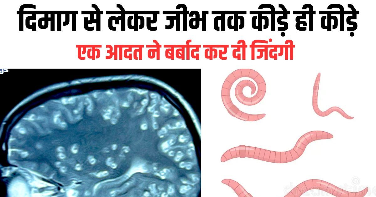 दिमाग में कीड़े ही कीड़े... ऐसा क्या खाता था शख्स? BHU के डॉक्टर ने ...