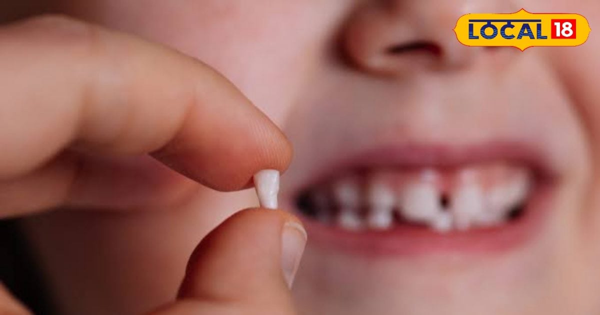 Birth teeth is important to child this is a precaution to keep healthy ...