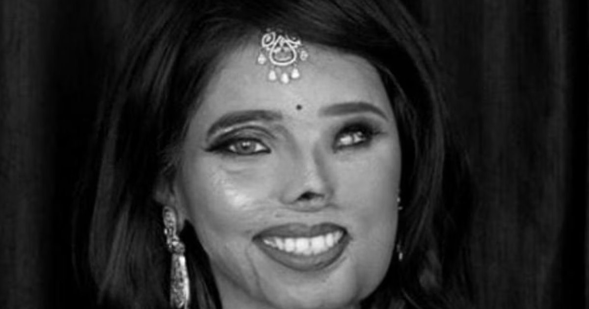 #HumanStory: एसिड अटैक सर्वाइवर जिनकी चमकीली मुस्कुान से आज रैंप ...