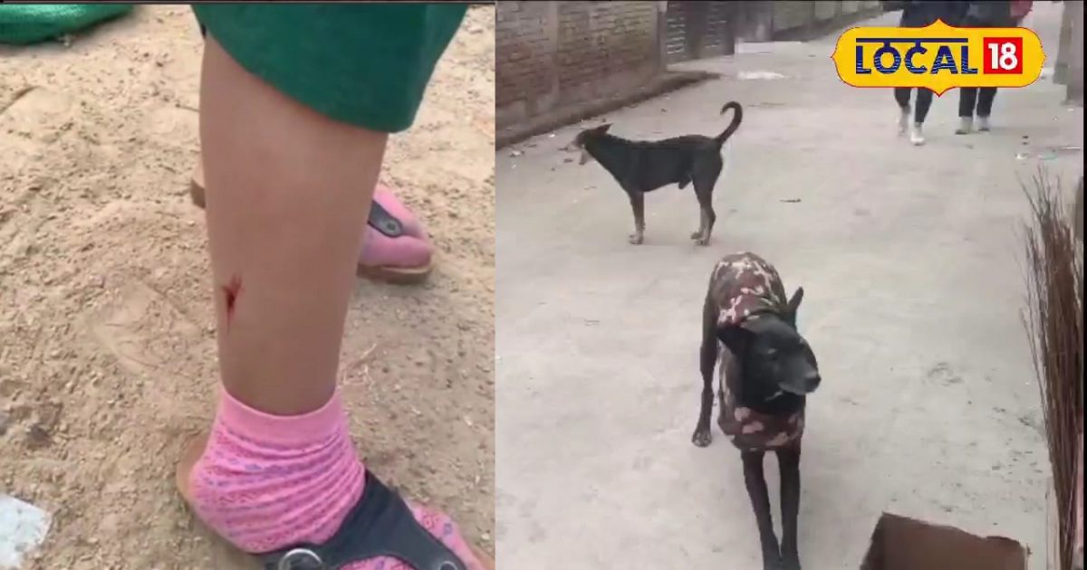 dog-bite-cases-increasing-delhi-elderly-women-children-becoming-victims ...