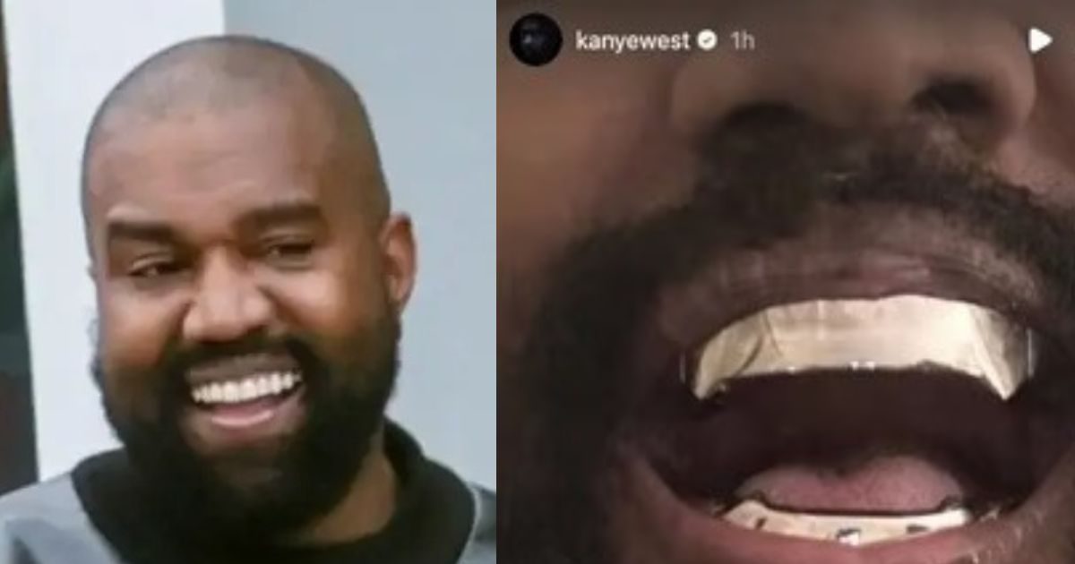 बाप रे! सोने-हीरे से भी महंगा, कान्ये वेस्ट ने अपने दांत की जगह लगाई यह ...