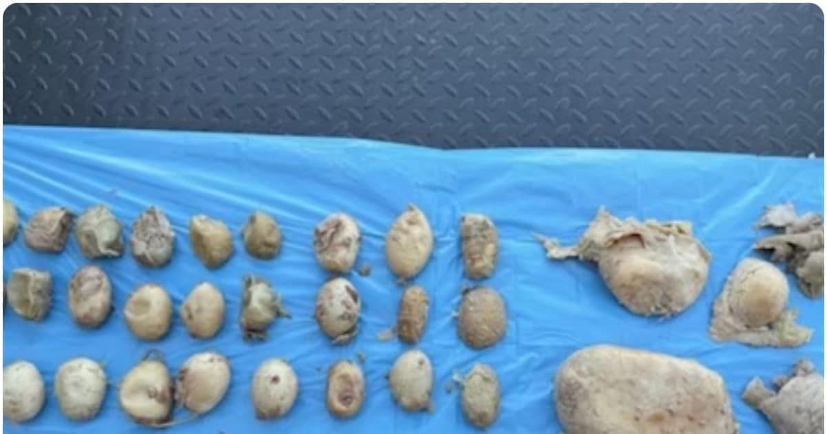 'सेरा' का ऑपरेशन कर रहे थे वनतारा के डॉक्टर, पेट की हालत देख उड़े होश ...