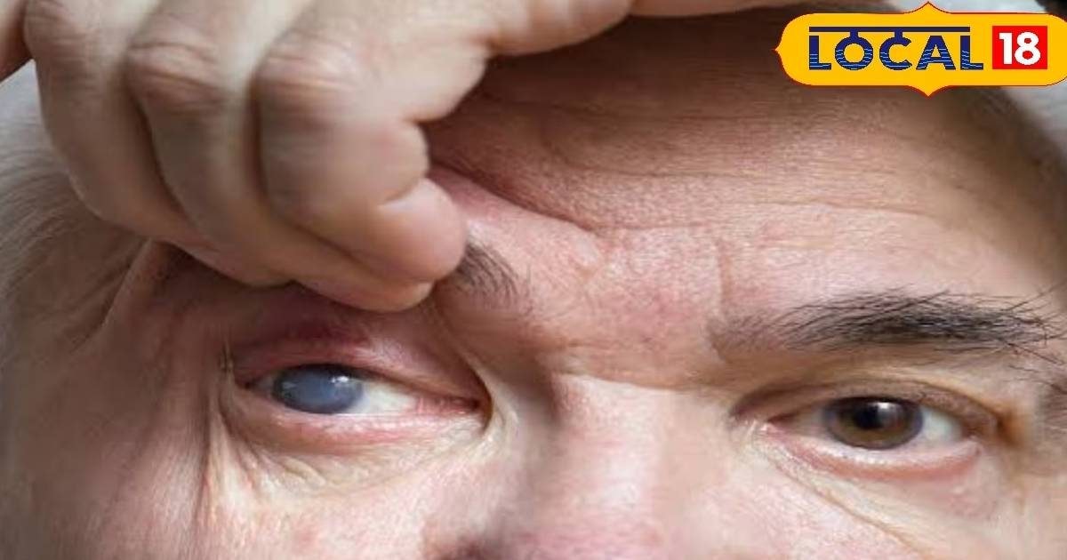 The risk of cataract increases with increasing age know motiyabind ...
