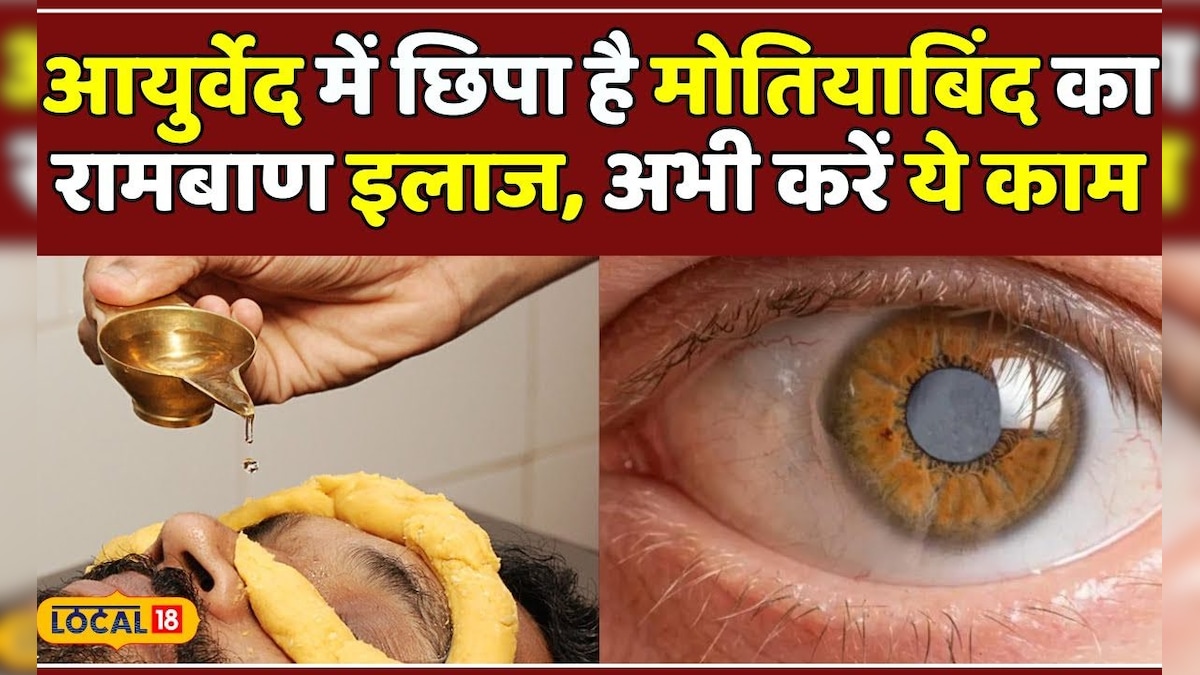 Motiyabind Ka Ilaj: आयुर्वेद में छिपा है मोतियाबिंद का इलाज, जानें पूरा ...