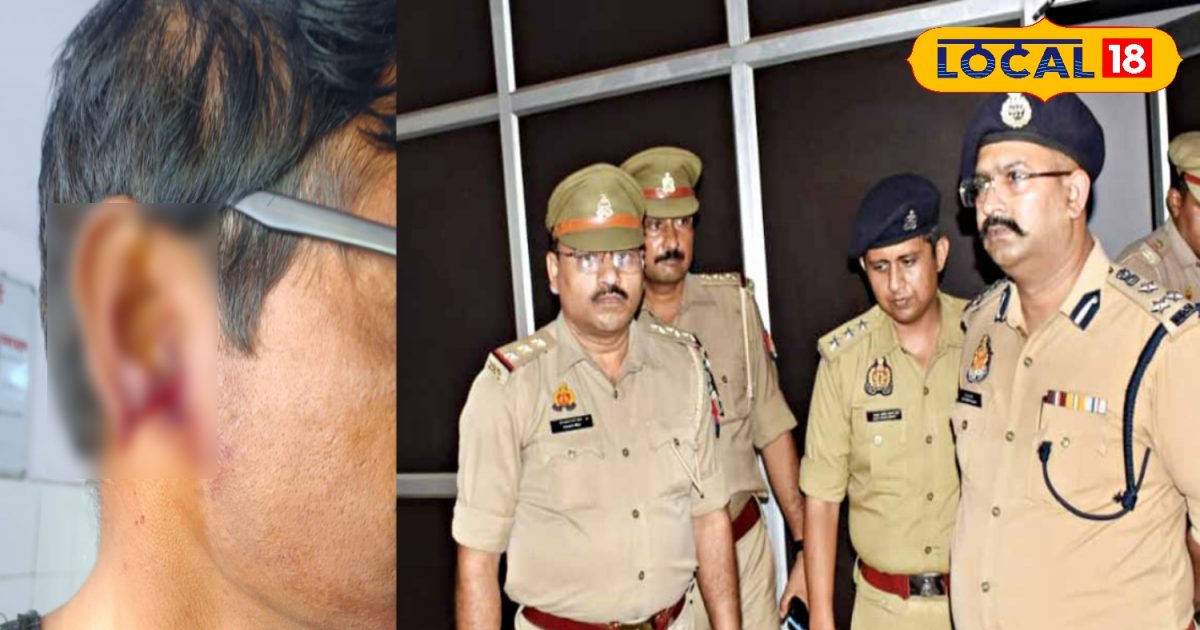 woman first chewed the man's ear and then chewed it and swallowed it to ...