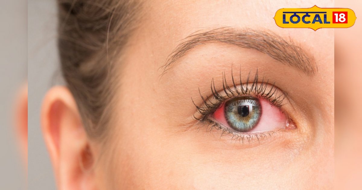 If color or gulal gets into your eyes during Holi, then do these ...