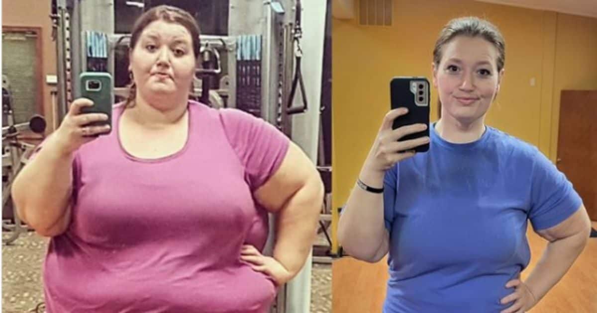 फ‍िट होने की ऐसी चाहत, 141 क‍िलो घटा ल‍िया वजन, जान जाते-जाते बची ...