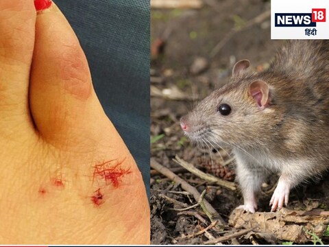 चूहा-छछुंदर के काटने से भी हो सकता है रेबीज? लगवानी चाहिए वैक्सीन? हेल् ...
