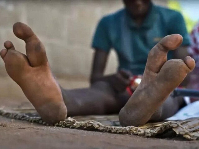 2 उंगलियों के साथ पैदा होते हैं इस जनजाति के बच्चे, शुतुरमुर्ग जैसे हैं ...
